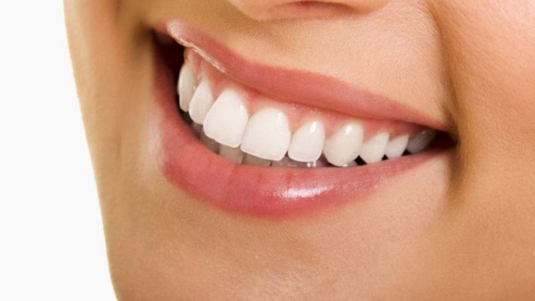 Dentist in San Antonio,TX | Dental Oral Care Near Me - Heritage Dental